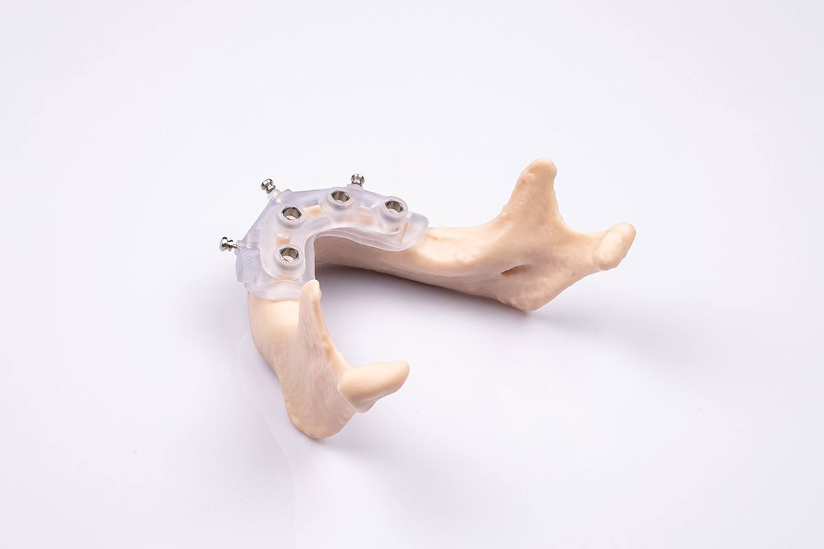 Surgical Guide UV - 3D Printing Materials - HeyGears