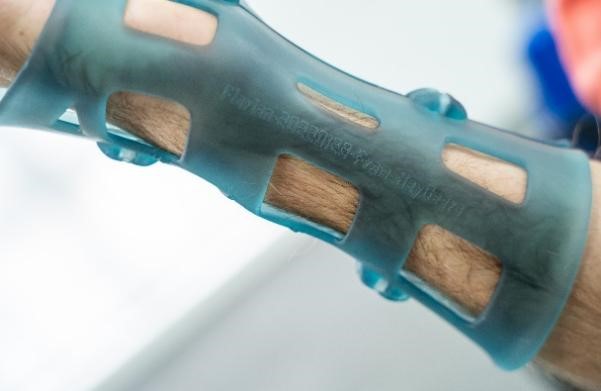 HeyGears - 3d printing - Case Study - X-Comfort Brace