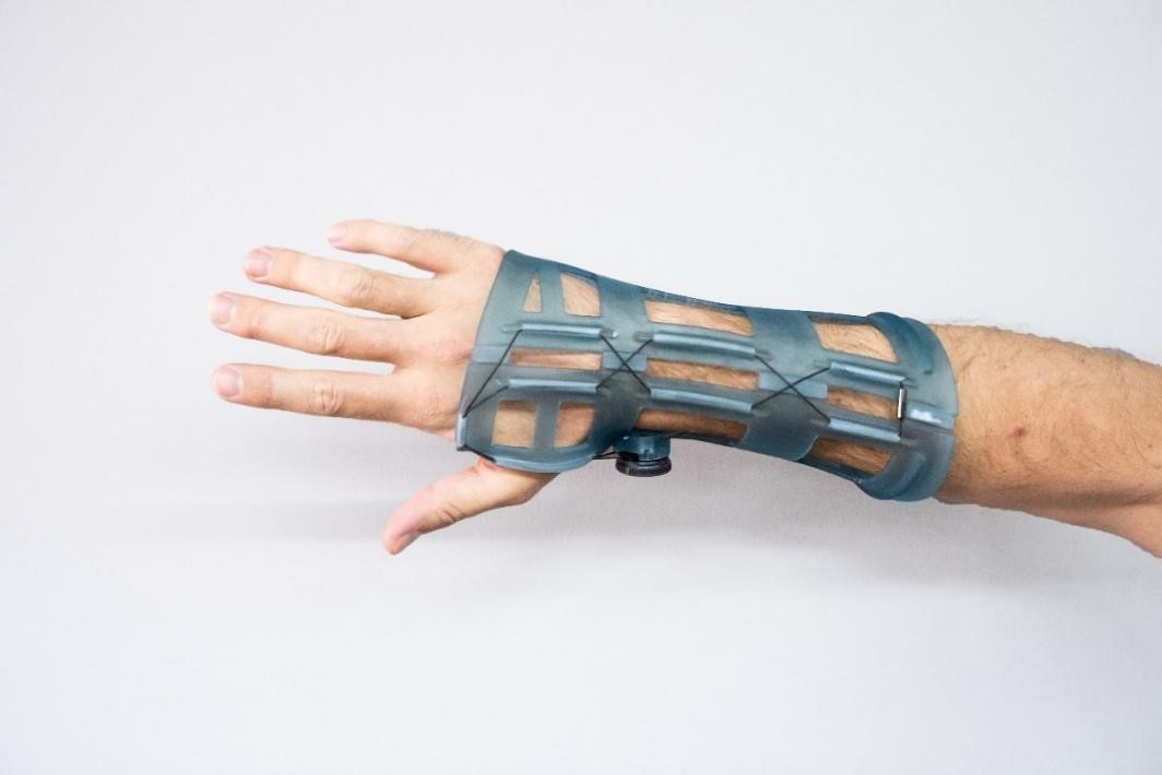 HeyGears - 3d printing - Case Study - X-Comfort Brace