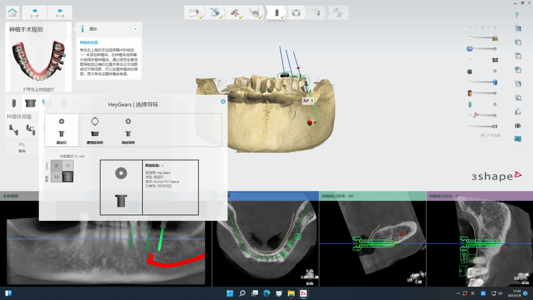 官宣！黑格科技携手3Shape、exocad：齿科数字化流程再优化