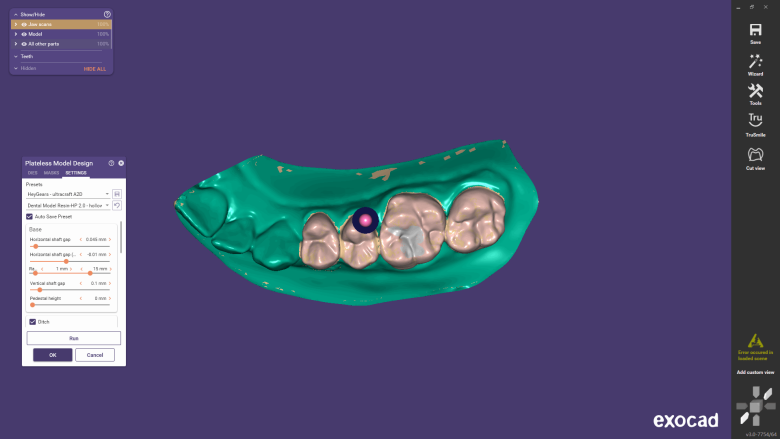 HeyGears Presets with 3Shape and exocad: Optimize Your Digital ...