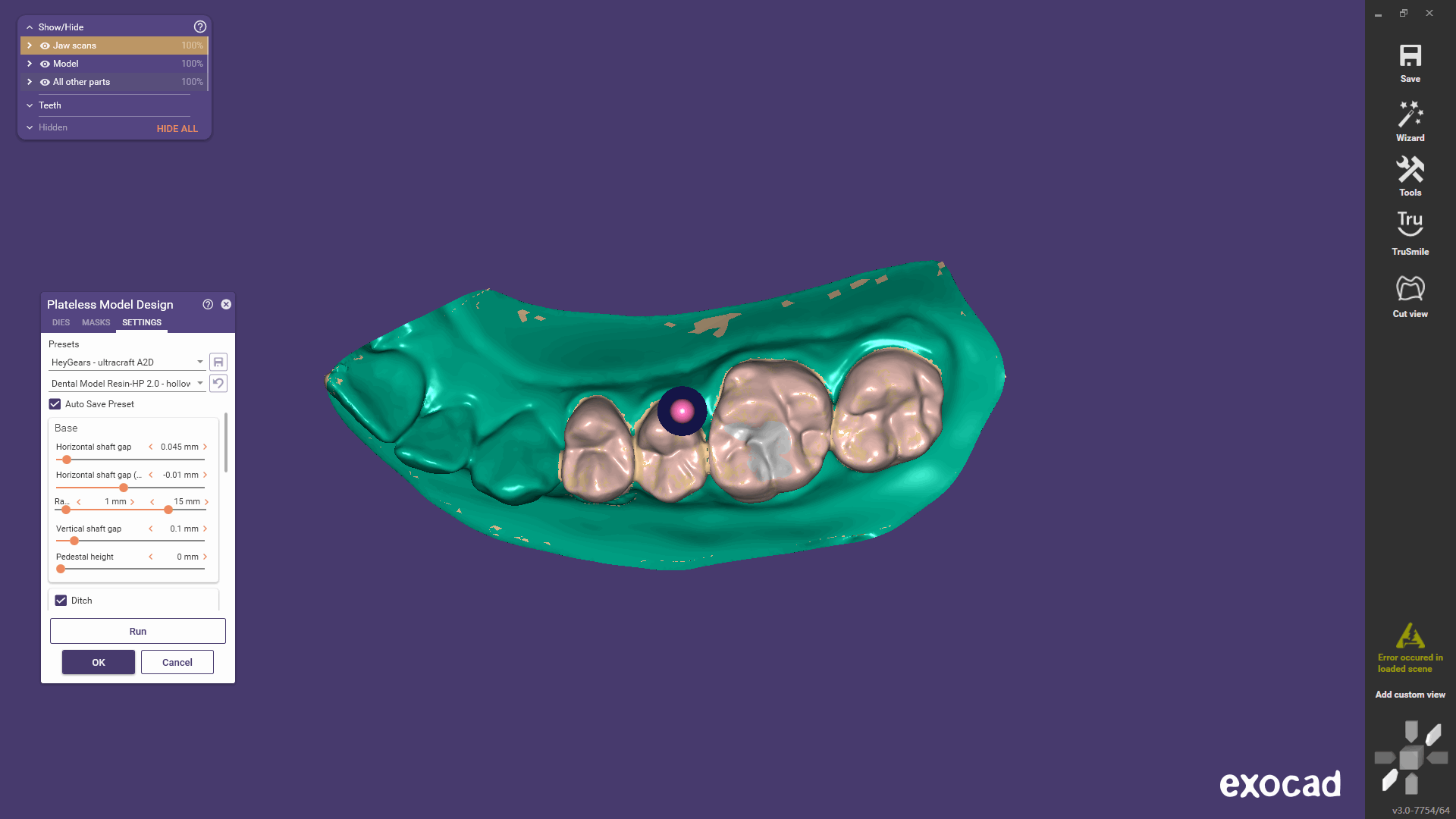 HeyGears Presets with 3Shape and exocad: Optimize Your Digital Dentistry Process