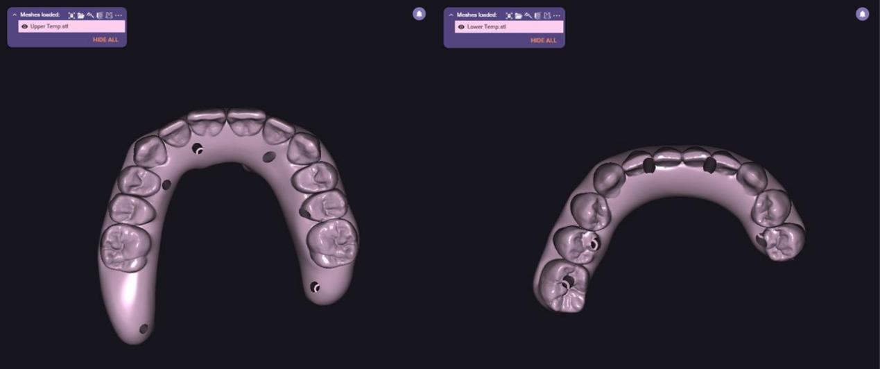 Patient Case Study | Dr. Jedediah Wooldridge Producing Full-arch Dentures