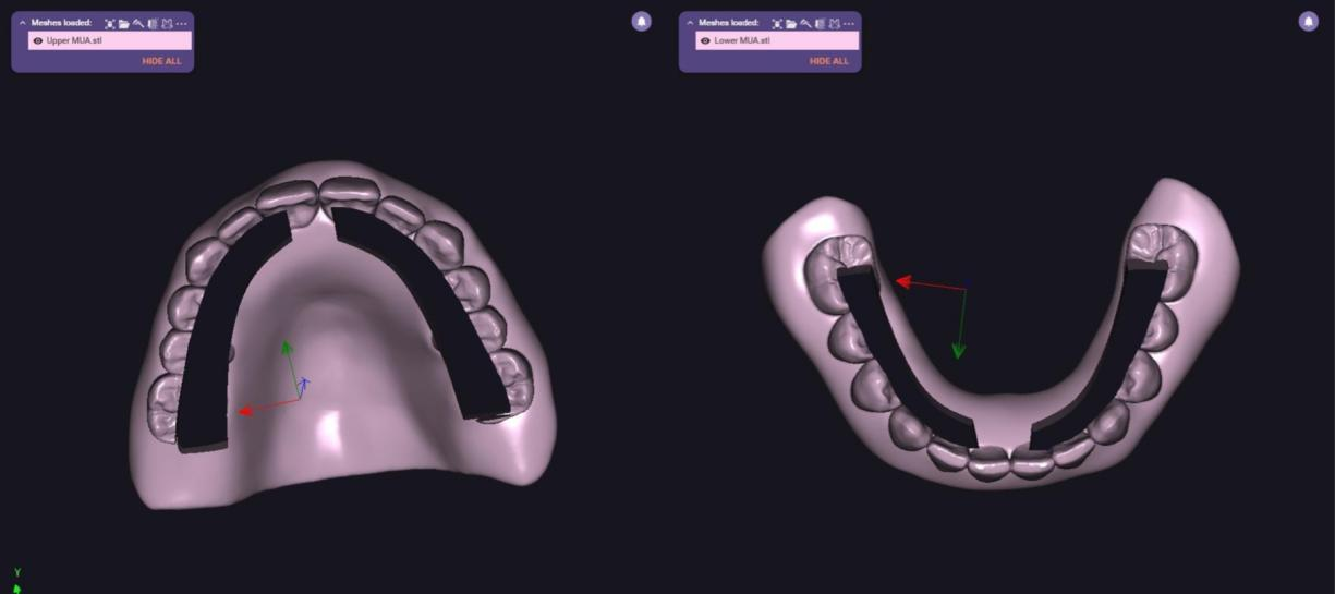 Patient Case Study | Dr. Jedediah Wooldridge Producing Full-arch Dentures
