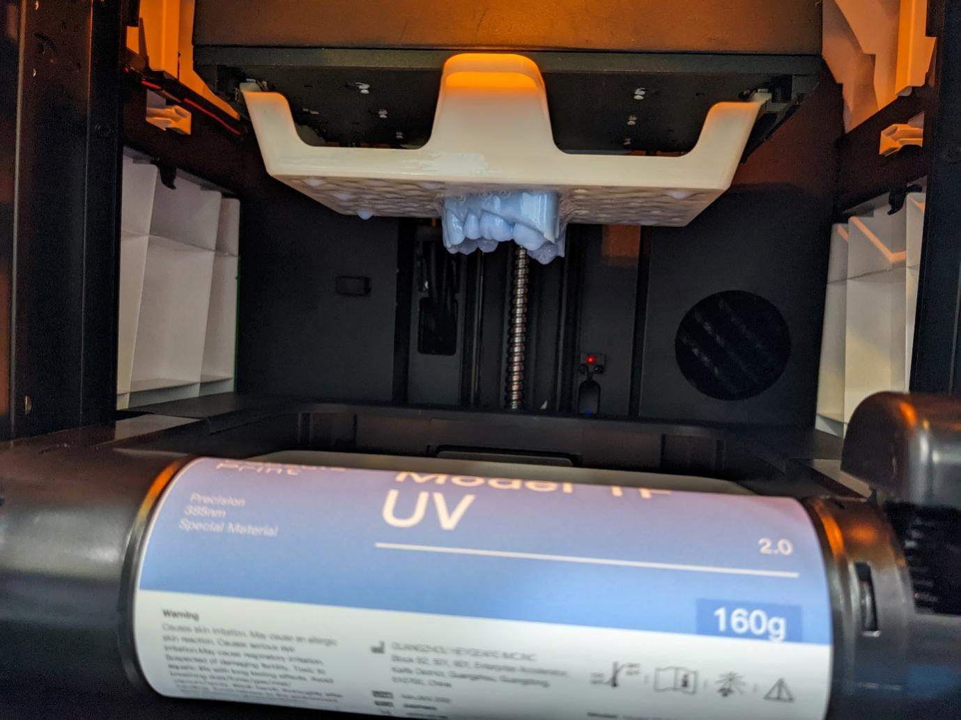 UltraCraft ChairSide: In-depth Look by Dr. Andrew Ip